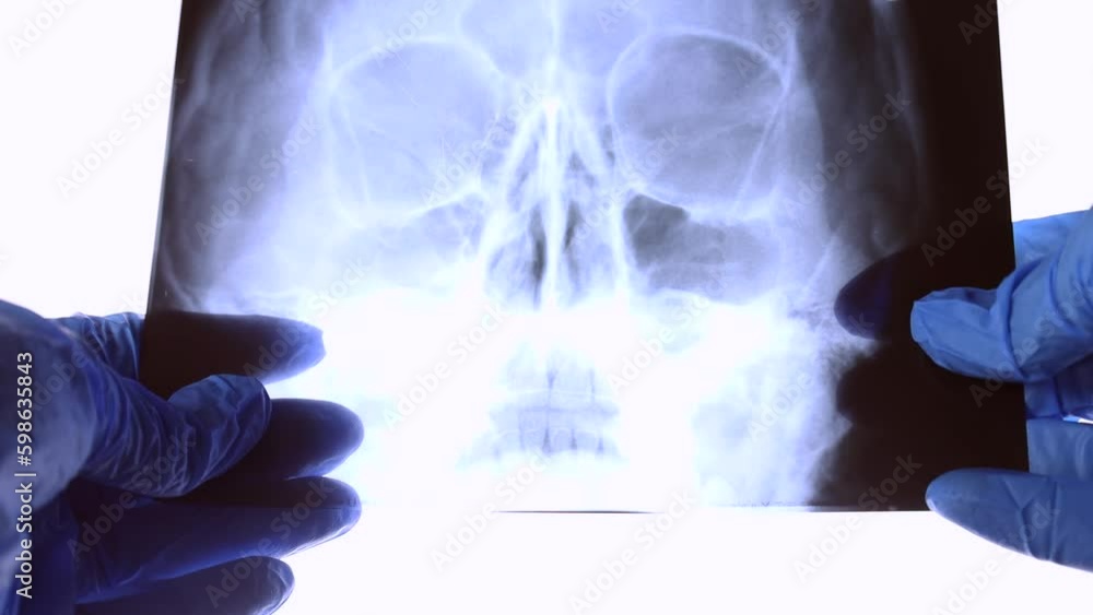 X ray scan of human skull in doctor hands. Ct head scanning on light ...