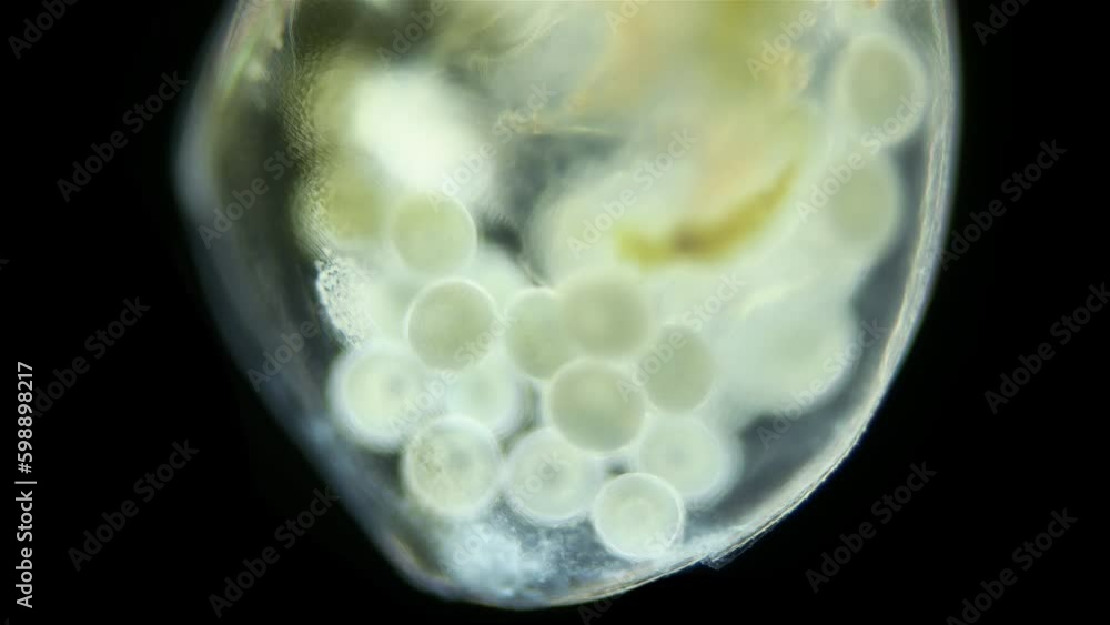 Water flea Daphnia Simocephalus vetulus under a microscope, class ...
