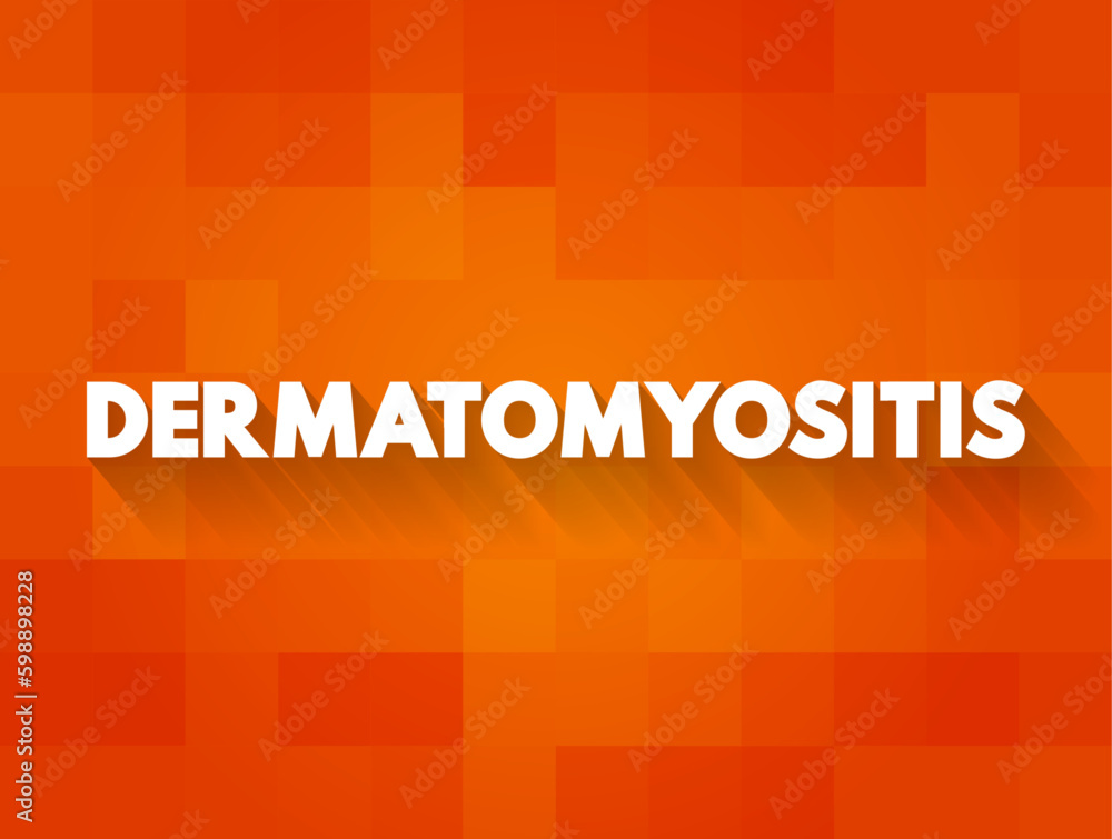 Dermatomyositis is an uncommon inflammatory disease marked by muscle ...