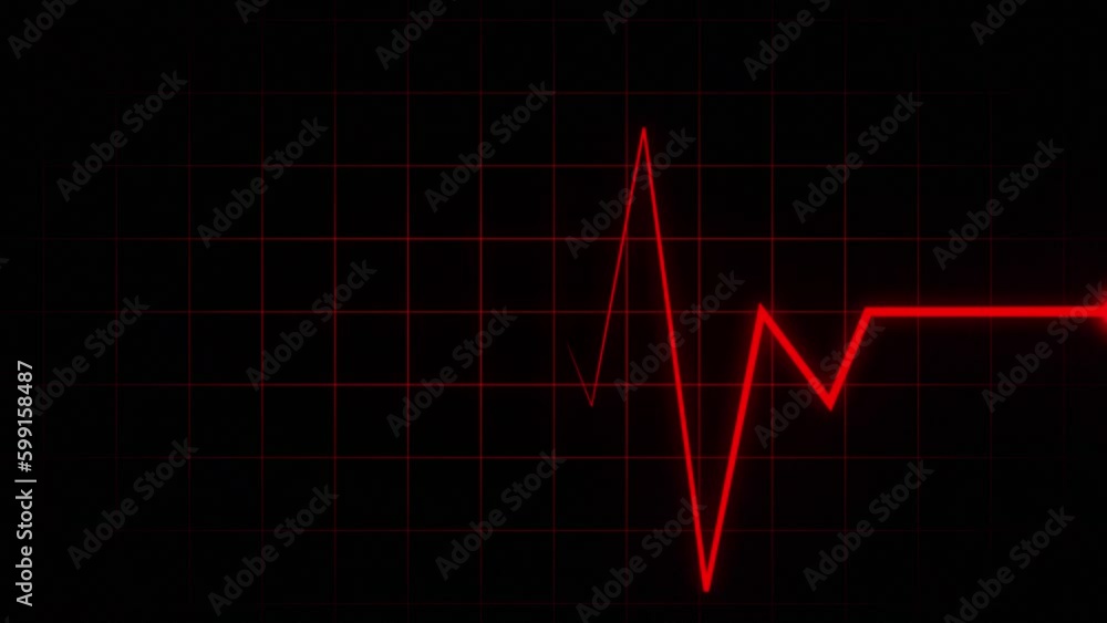 Heart Rhythm Background EKG line monitor shows heartthrob, Seamlessly ...