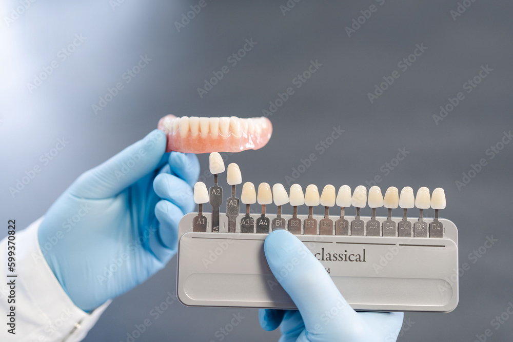 Dental technician hold palette of shades of teeth scale. Close up of ...