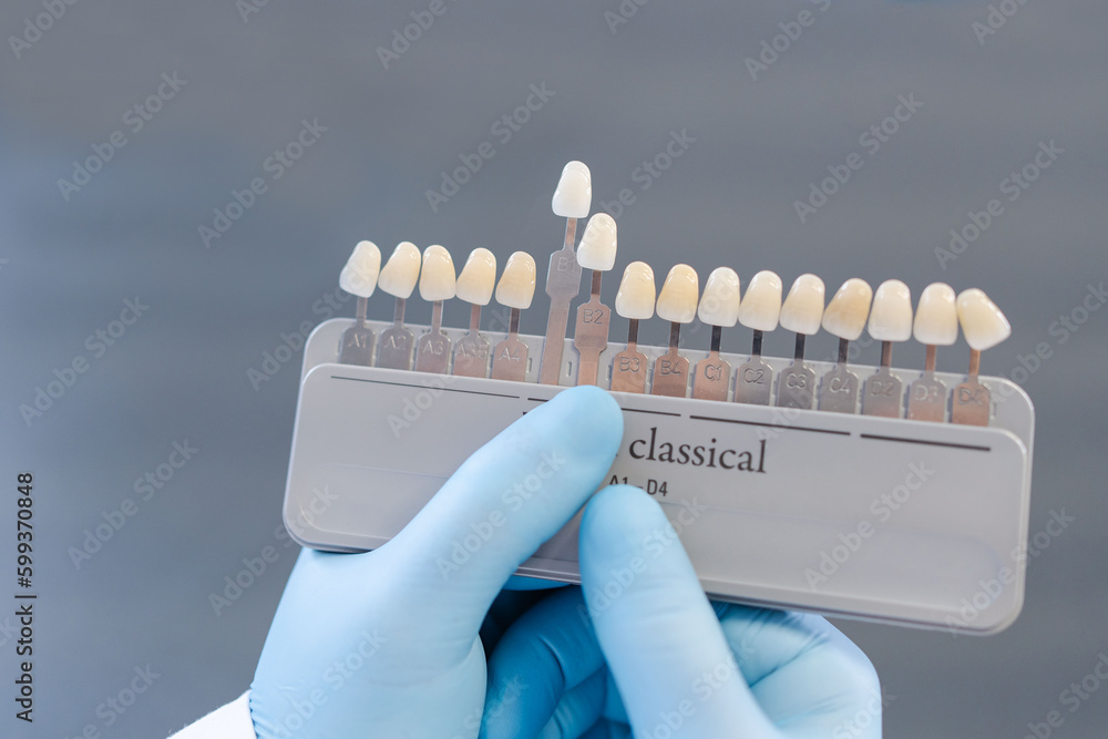 Foto de Close up of shade guide to check veneer of tooth crown in a ...