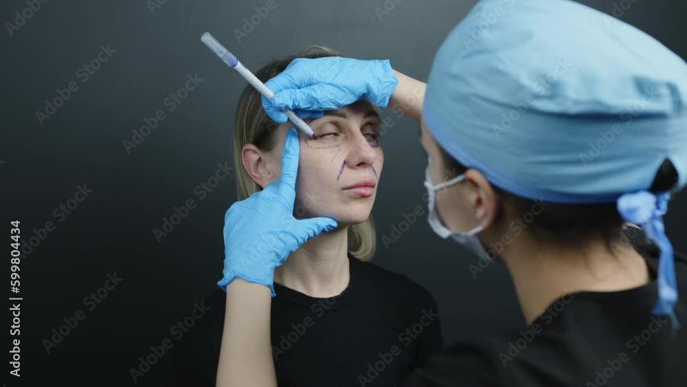Over the shoulder shot of process of surgical marking of female face ...