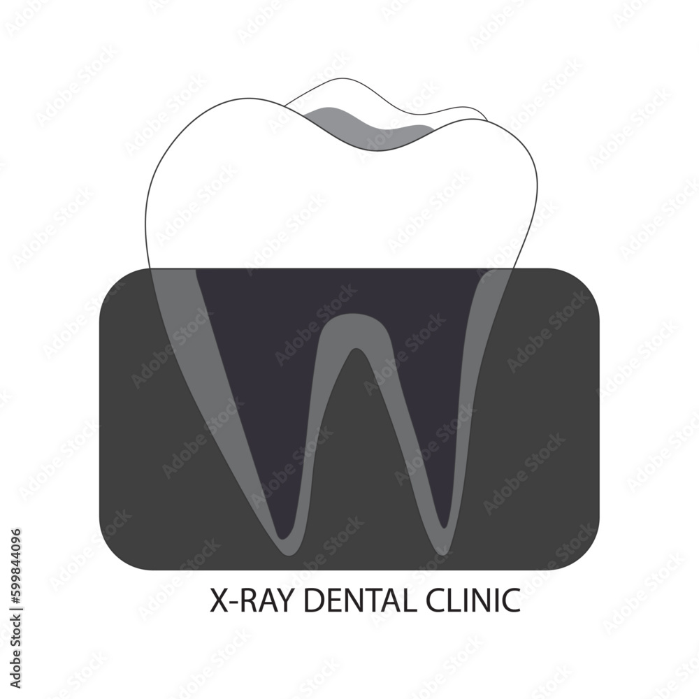 Dental clinic logo template, dental care logo designs with x-ray style ...