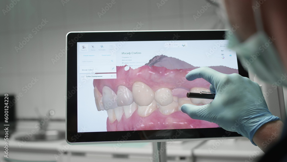 Stockfoto A professional dentist man looks at a 3d model of teeth on a ...