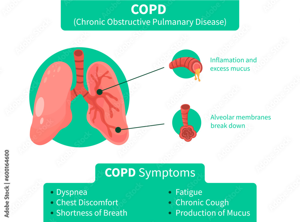 human Lungs vector clip art icon. COPD vector illustration, chronic ...
