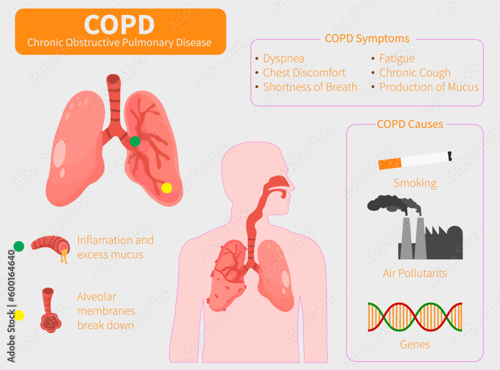 human Lungs vector clip art icon. COPD vector illustration, chronic ...
