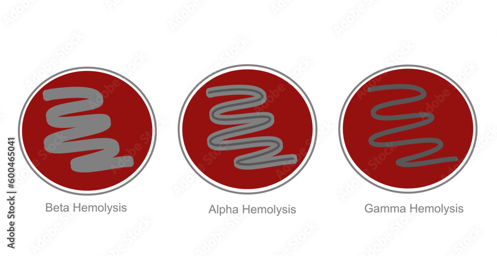 The classification bacteria growth on Blood agar that represents the ...