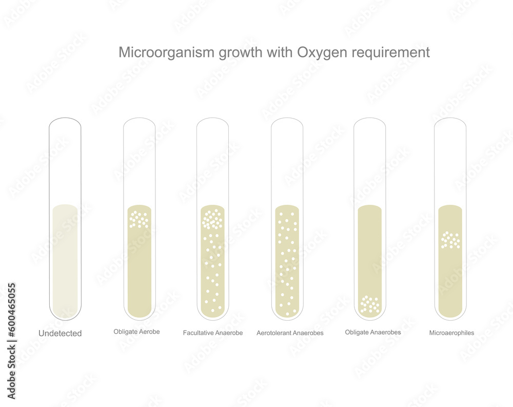The bacterial identification of microorganism growth with oxygen ...