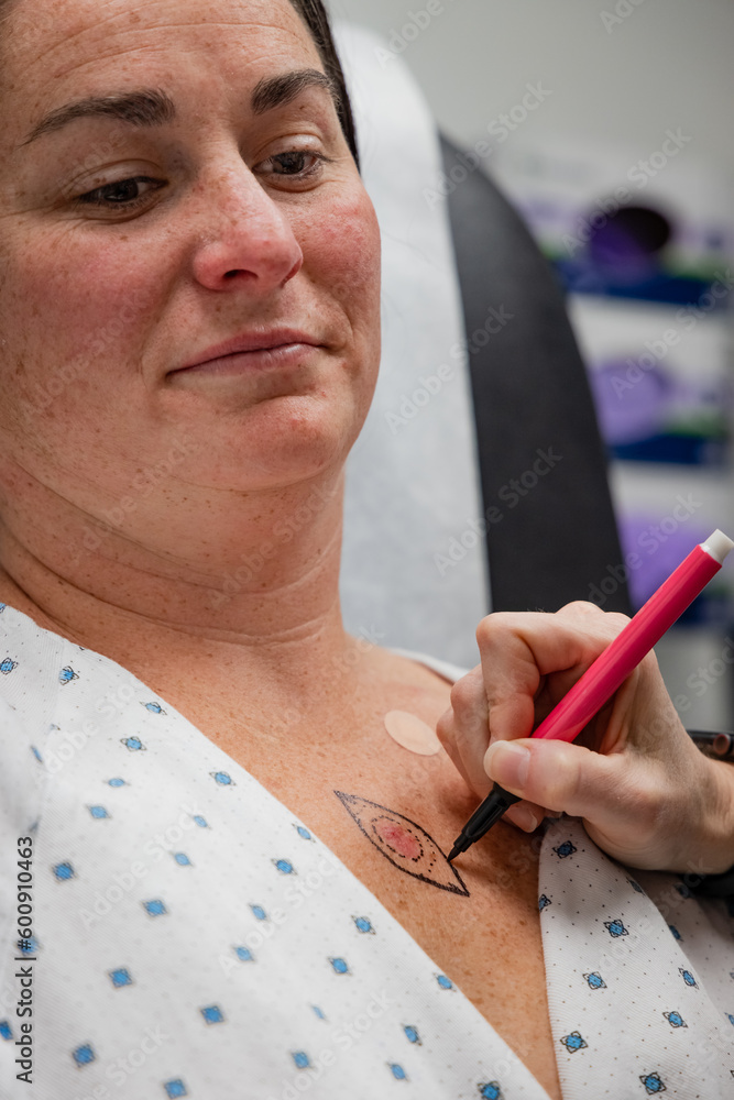 Dermatologist consults patient after drawing on young 30s woman chest ...