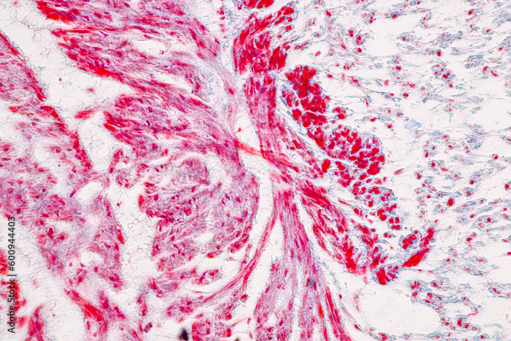 Histological Uterus human, Uterine tube human, Placenta human and ...