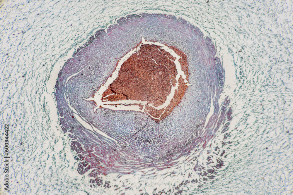 Histological Uterus human, Uterine tube human, Placenta human and ...