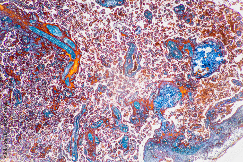 Histological Uterus human, Uterine tube human, Placenta human and ...