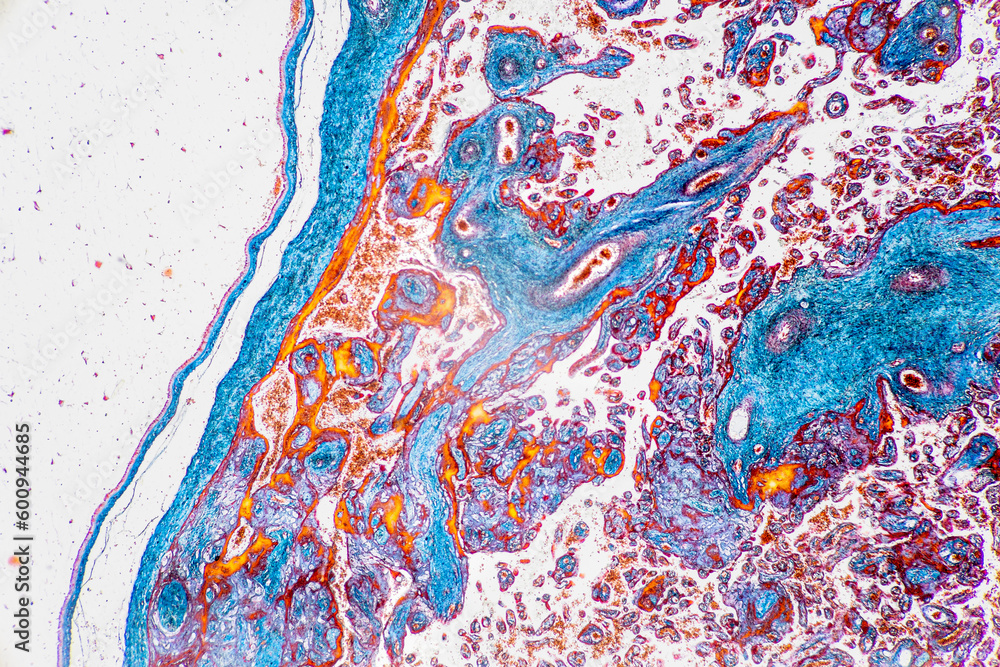 Foto de Histological Uterus human, Uterine tube human, Placenta human ...