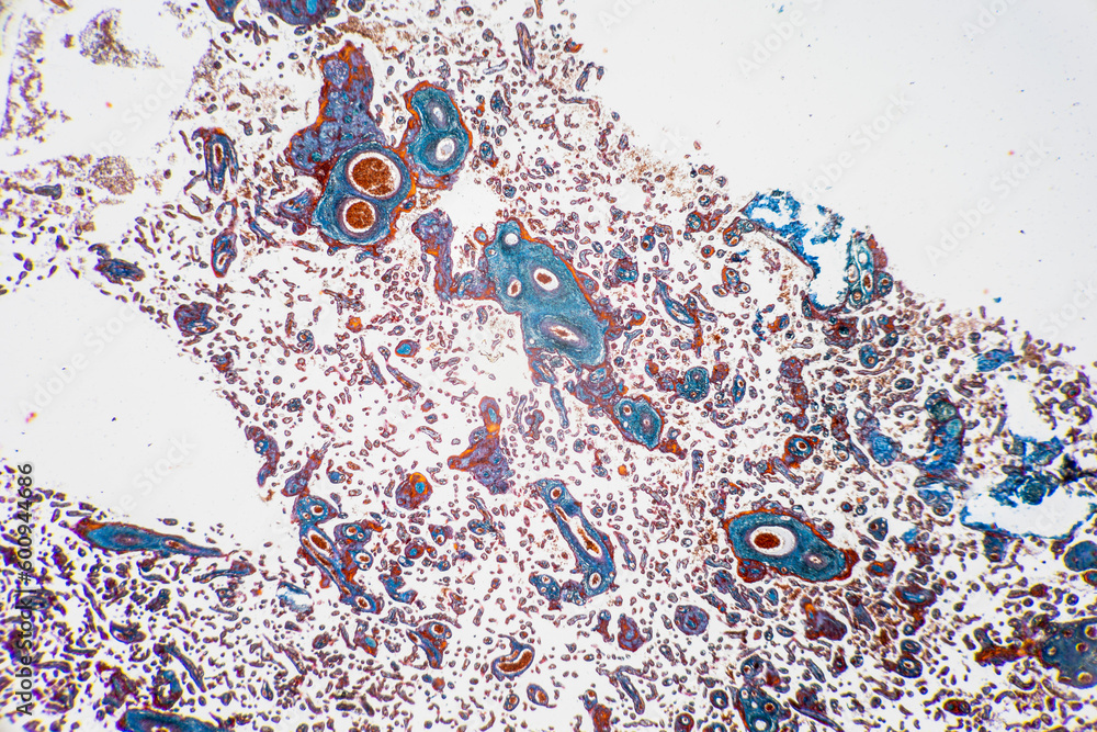 Histological Uterus human, Uterine tube human, Placenta human and ...