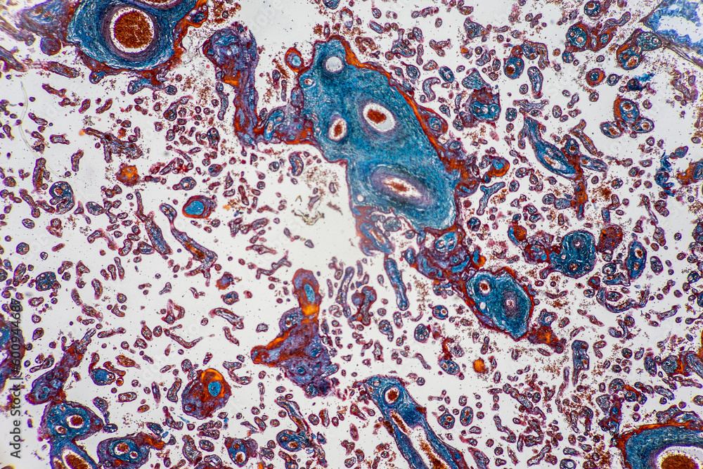 Histological Uterus human, Uterine tube human, Placenta human and ...