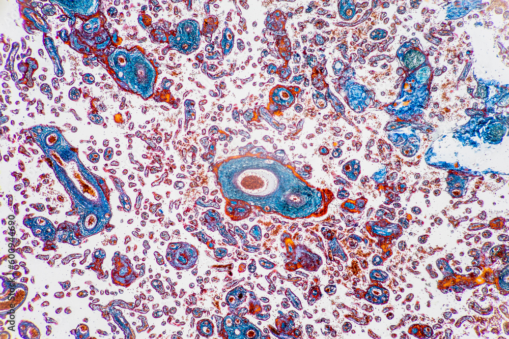 Histological Uterus human, Uterine tube human, Placenta human and ...