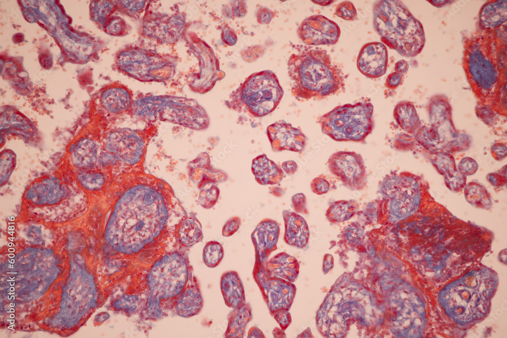 Histological Uterus human, Uterine tube human, Placenta human and ...