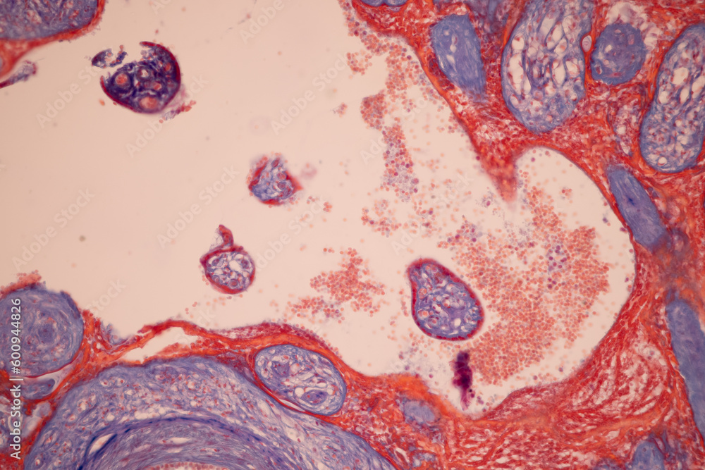 Histological Uterus human, Uterine tube human, Placenta human and ...