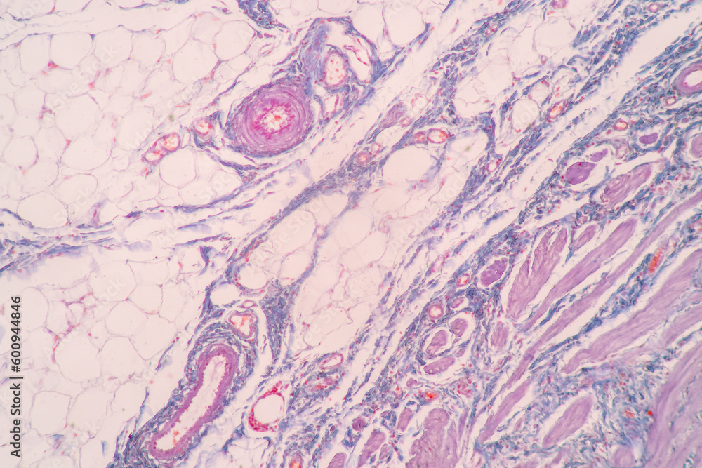Histological Uterus human, Uterine tube human, Placenta human and ...