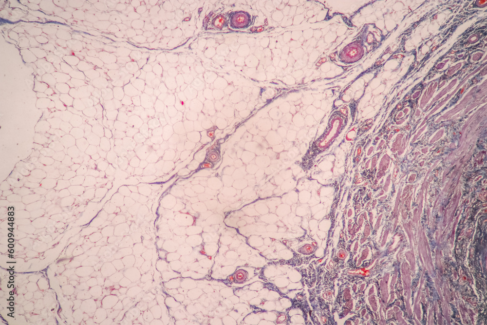 Histological Uterus human, Uterine tube human, Placenta human and ...