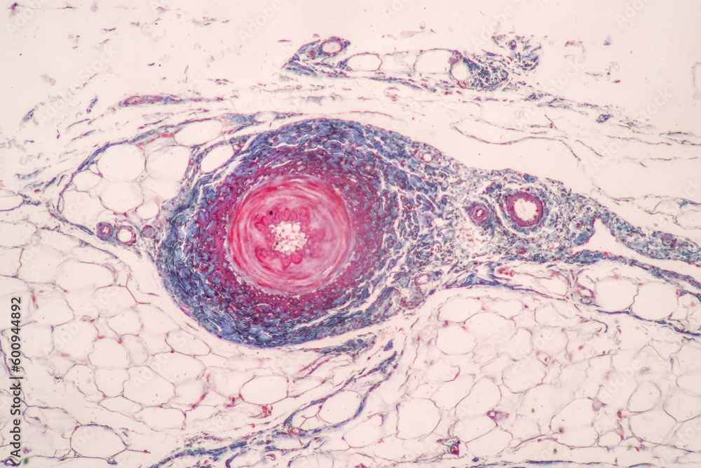 Histological Uterus human, Uterine tube human, Placenta human and ...