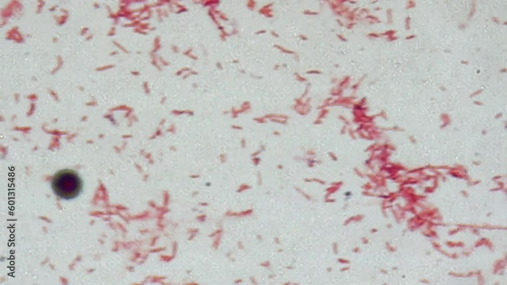 Bacteria cells under a microscope, bacteria magnified 1000 times. vídeo ...