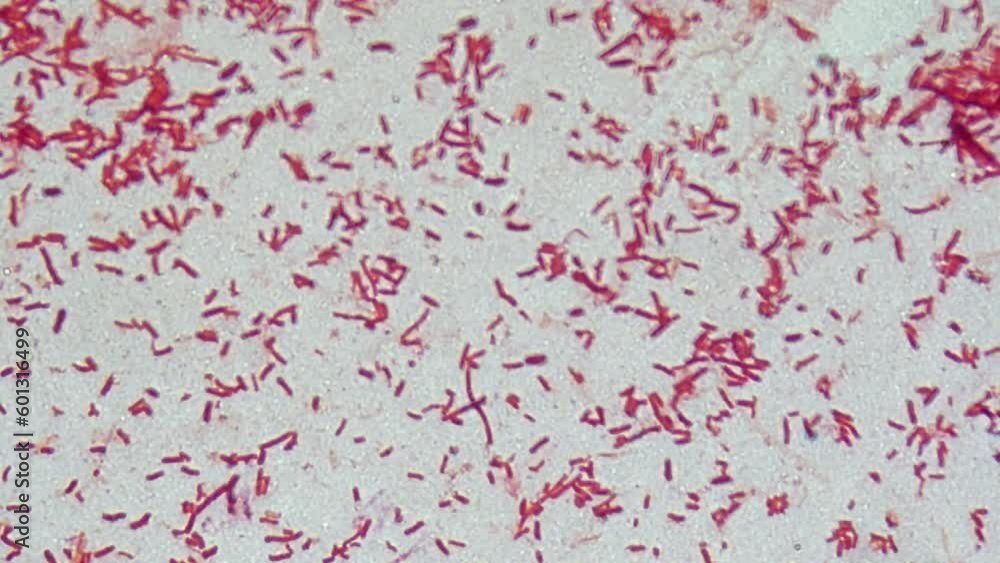 Red bacterial cells under microscope magnification on glass, a fixed ...