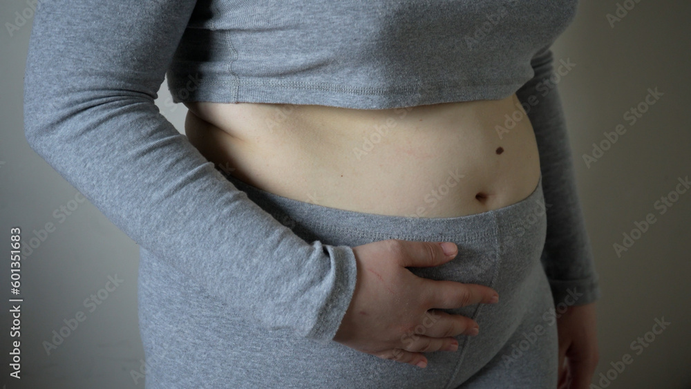 Young overweight or plus size woman with fat big belly, surgery and fat ...