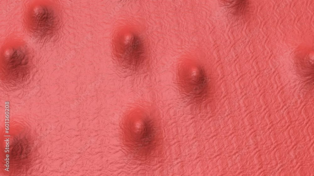 Red pimples and bumps. Skin texture with pimples. Bumps on human skin ...