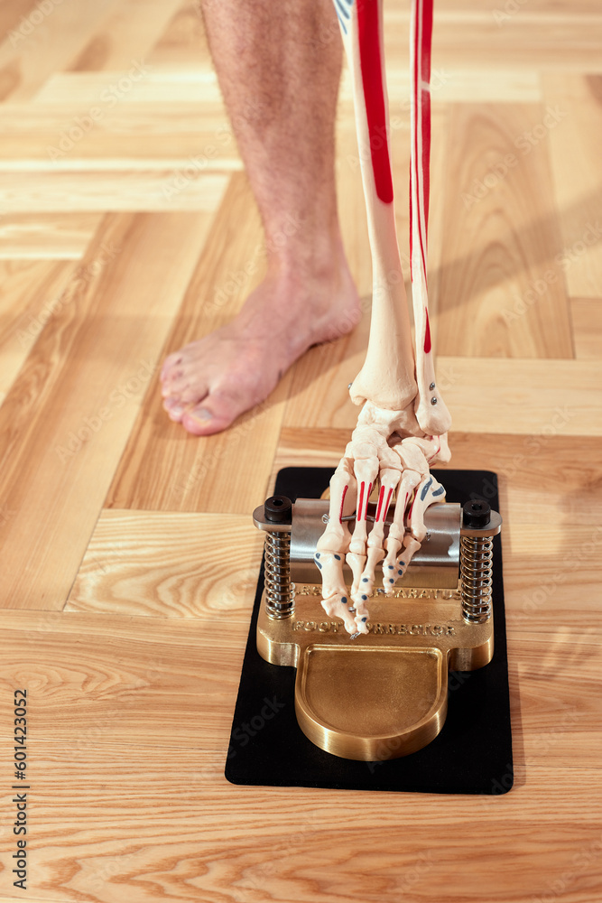 Diagnosis of flat feet human leg and medical skeleton and orthopedic ...