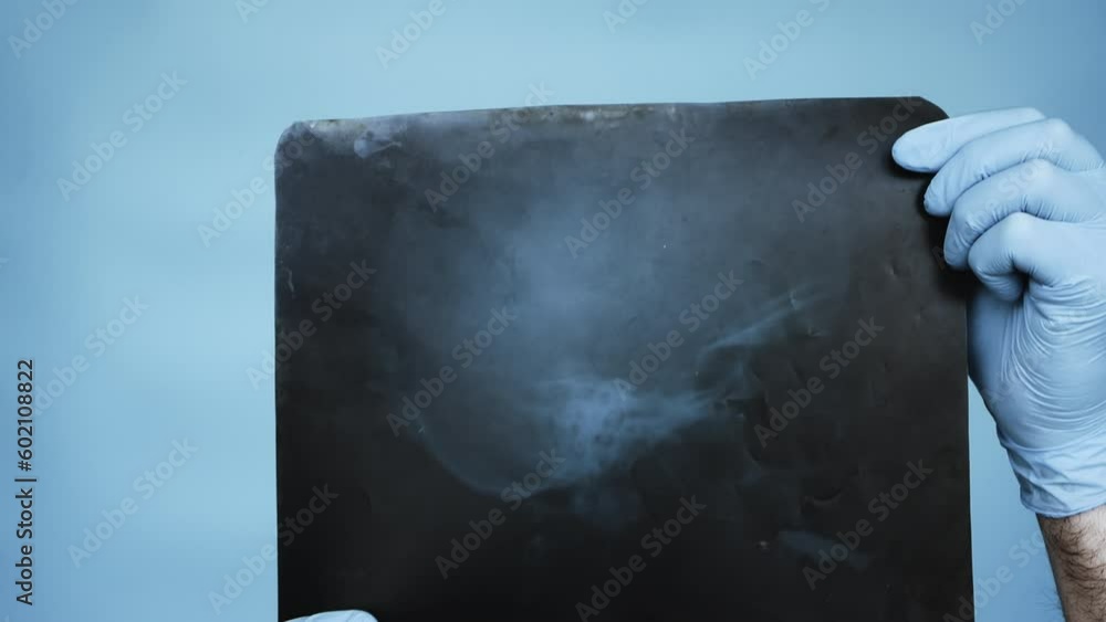 Close-up, X-ray of the human brain in the doctor's hands. Radiographer ...