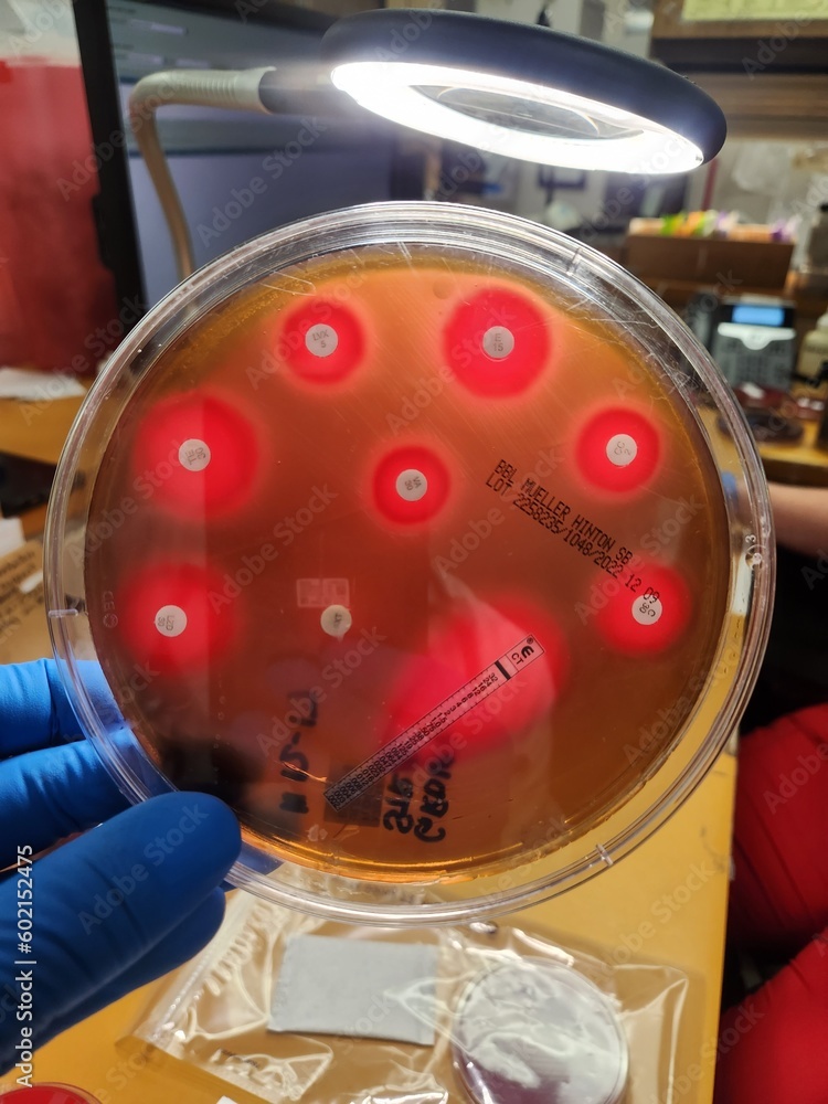 Streptococcal bacterial colonies on blood agar culture plates Stock ...