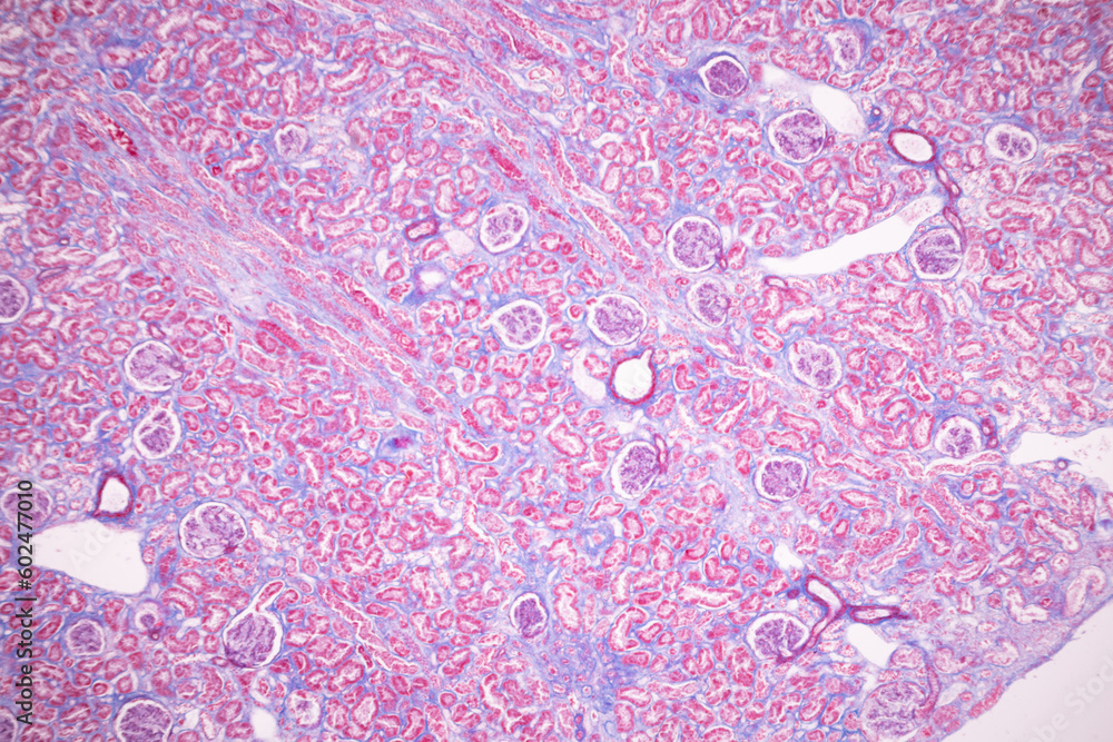 Foto de Histological Pancreas human, Liver human, Vermiform appendix ...