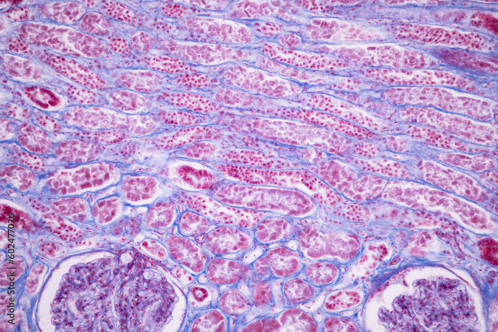 Foto de Histological Pancreas human, Liver human, Vermiform appendix ...