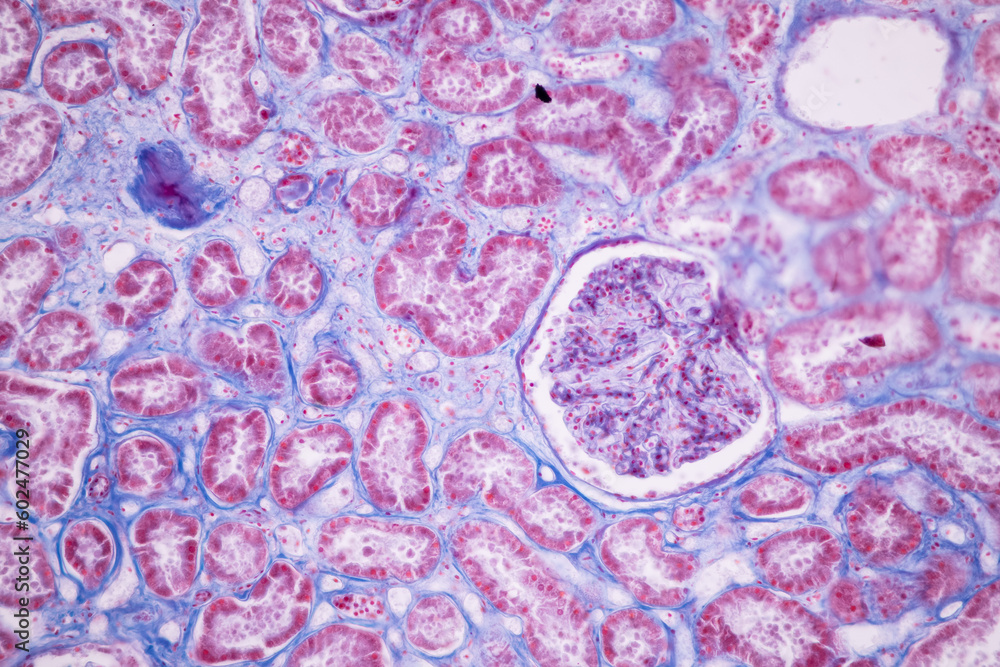 Foto de Histological Pancreas human, Liver human, Vermiform appendix ...