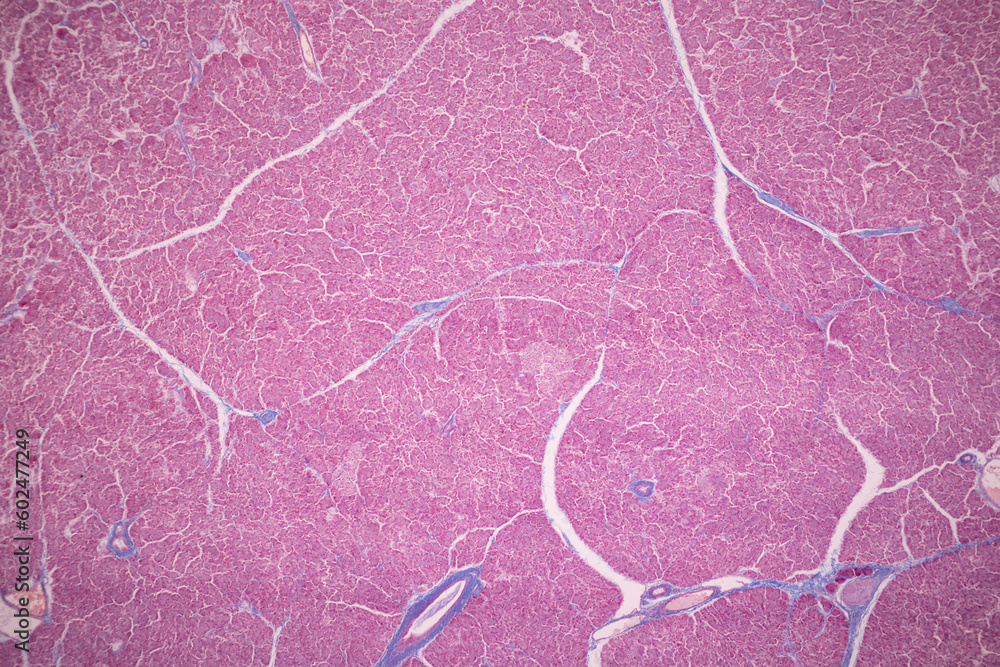 Foto de Histological Pancreas human, Liver human, Vermiform appendix ...