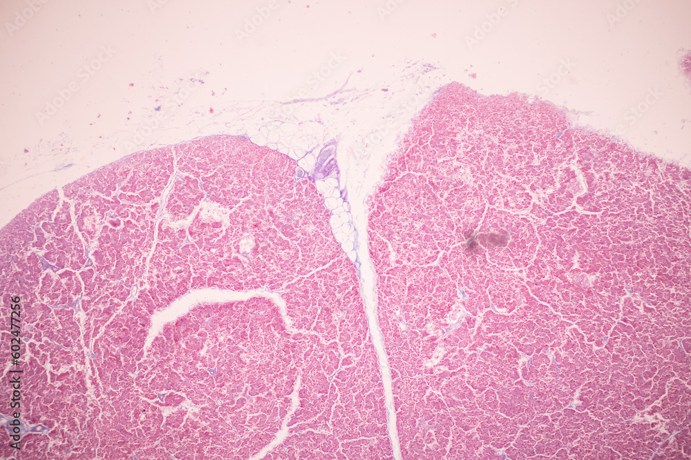 Foto de Histological Pancreas human, Liver human, Vermiform appendix ...