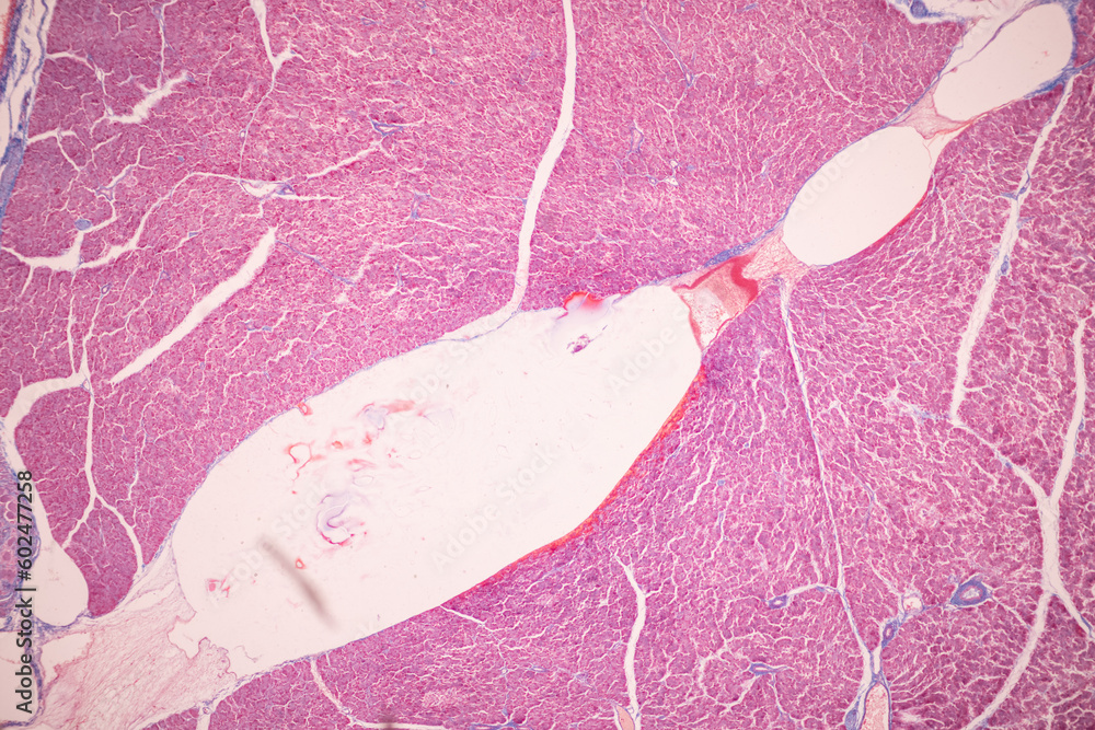 Foto de Histological Pancreas human, Liver human, Vermiform appendix ...