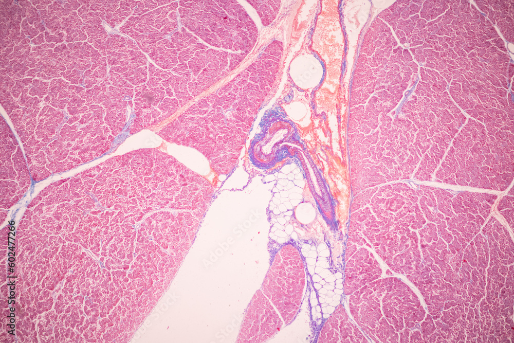 Histological Pancreas human, Liver human, Vermiform appendix human and ...