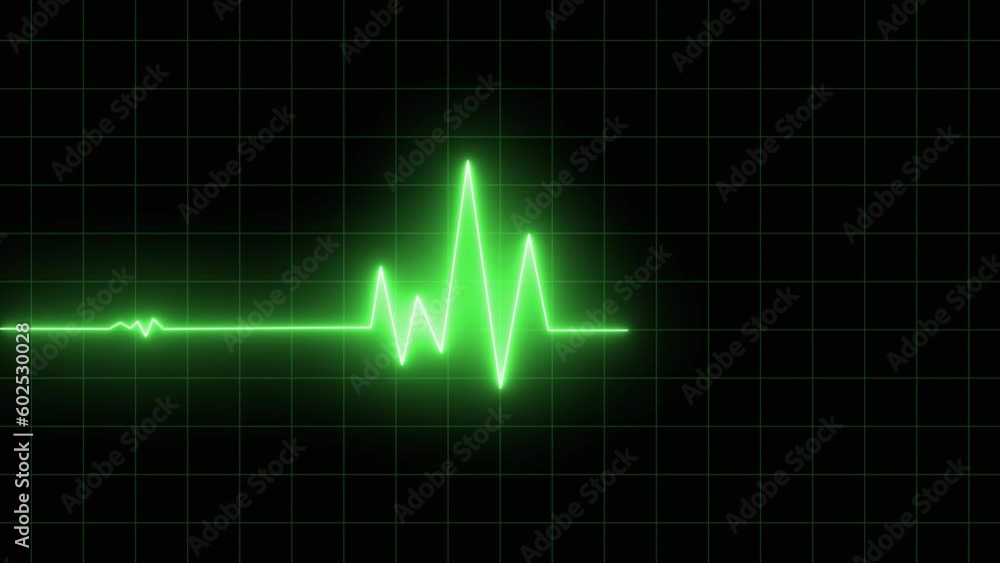 Heartbeat Monitor EKG Cardiogram Loopable. Seamless looping heart ...