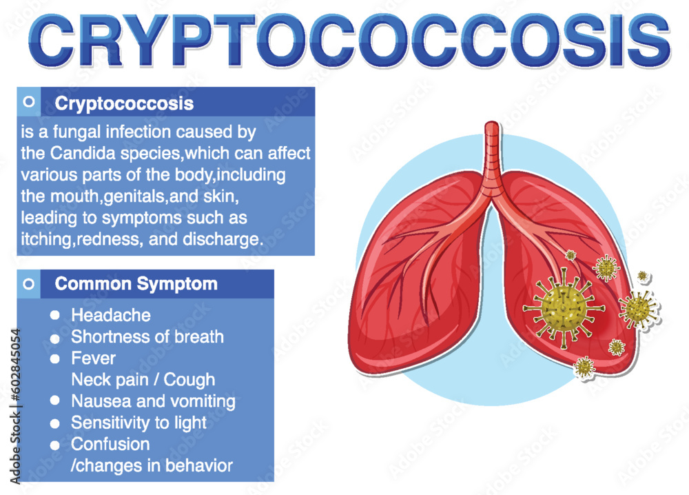 Informative poster of Cryptococcosis Stock Vector | Adobe Stock