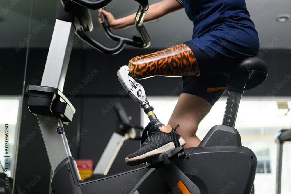 Disabled athlete patient with prosthetic leg doing exercise at gym ...