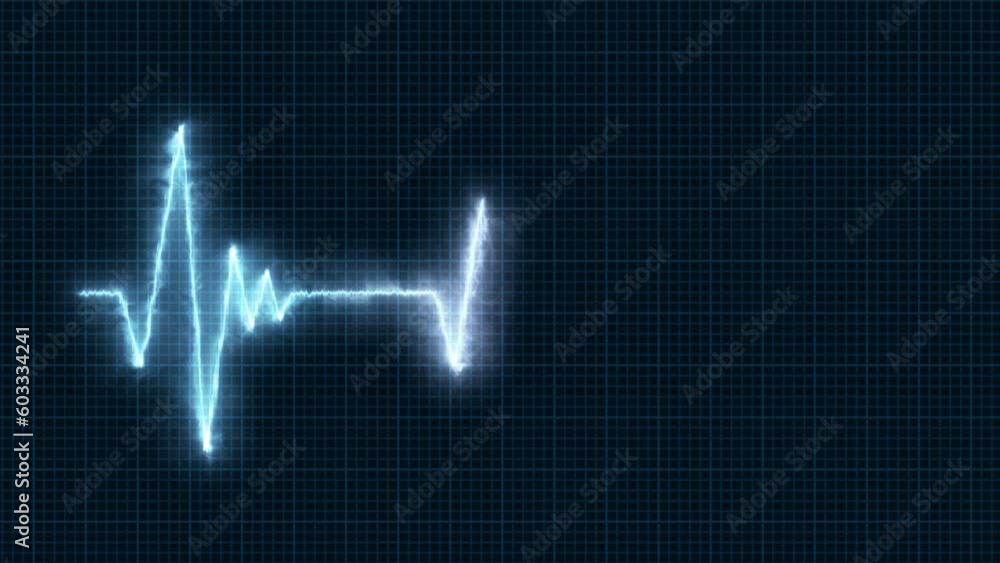 Animated heart beat pulse line displaying in cardiograph monitor Stock ...
