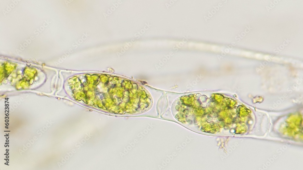 Asexual reproduction of Spirogyra sp. by forming zygospore. Fresh ...