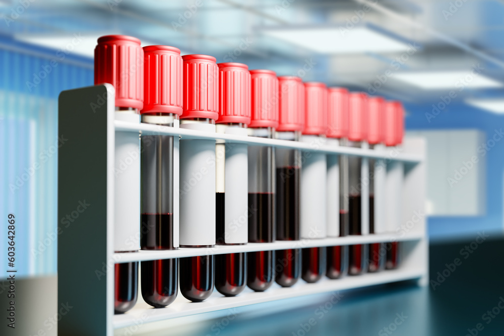Test tubes with blood. Blood group analysis. Plastic flasks in clinic ...