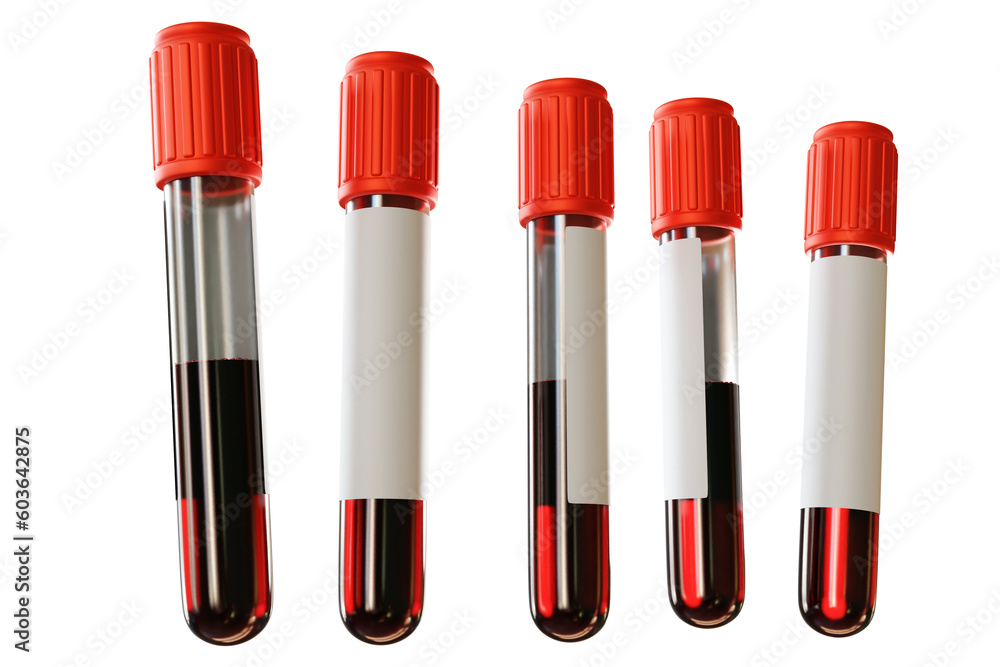 Test tubes with blood. Plastic medical flasks. Mock up prophet for ...