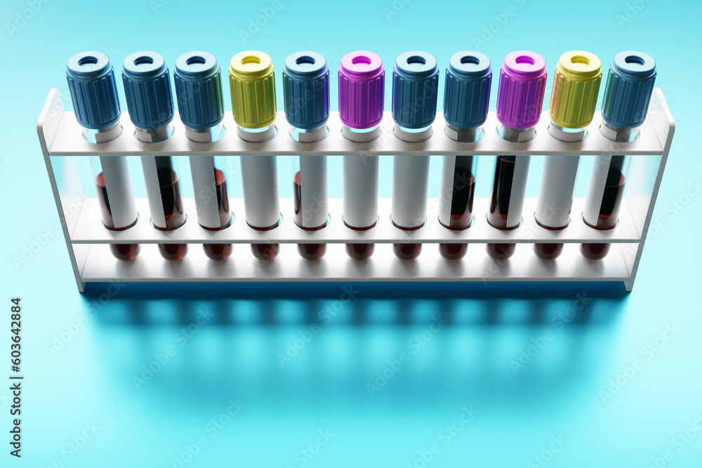 Rack with test tubes. Laboratory plastic flasks. Blood analysis ...