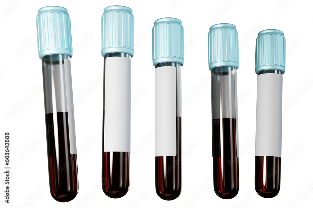Blood sample. Test tubes for analysis from different angles. Blood for ...