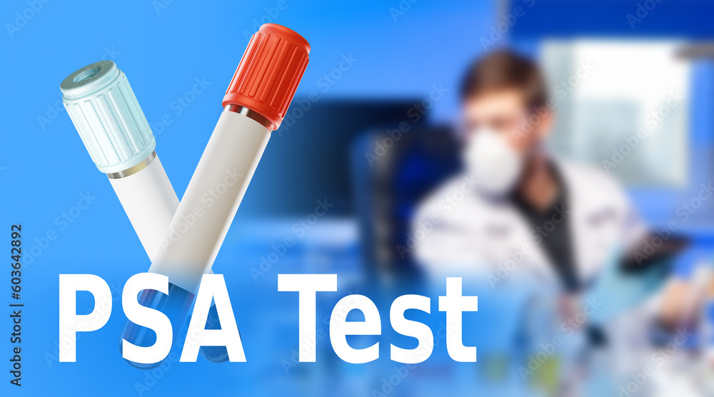 PSA test in clinic. Flasks for blood analysis. Biochemical studies of ...